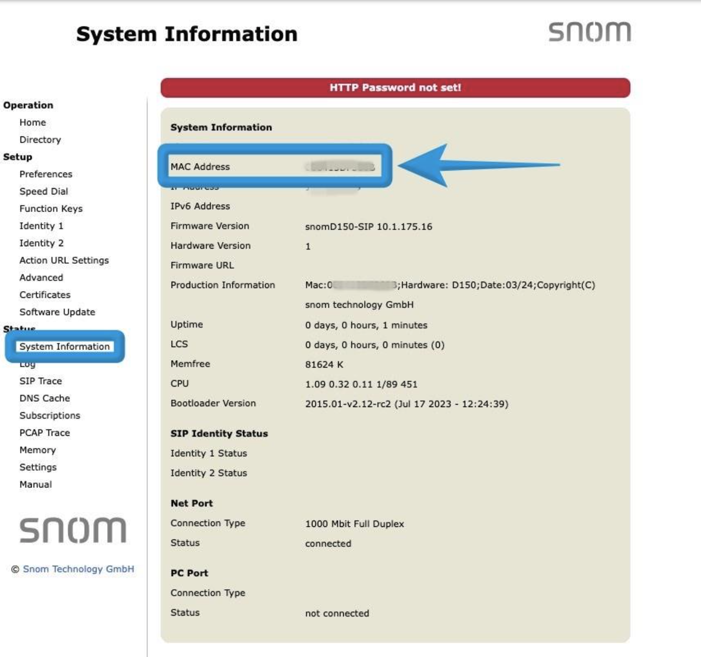How to configure the Snom D150 IP Phone with RingQ